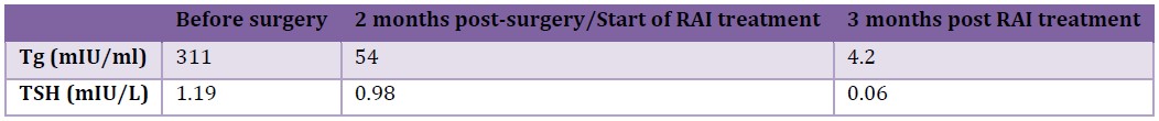 as a result of surgery this patient developed hypocalcaemia secondary