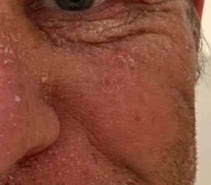figure 2 left side of the patient s face september 20 2021 the ...