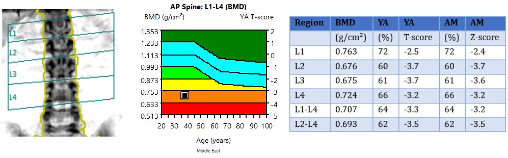 figure 1 spine bmd in 2018