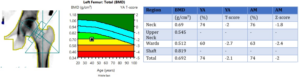 figure 8 left femur bmd in 2021 2022