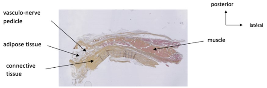 figure 2 histological view of a sample in axial view